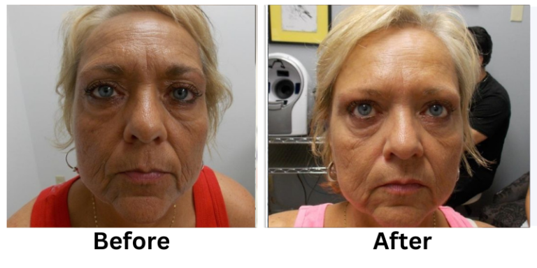 How Soon Will You Notice Changes After Starting HRT?