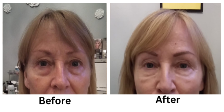 How Soon Will You Notice Changes After Starting HRT?