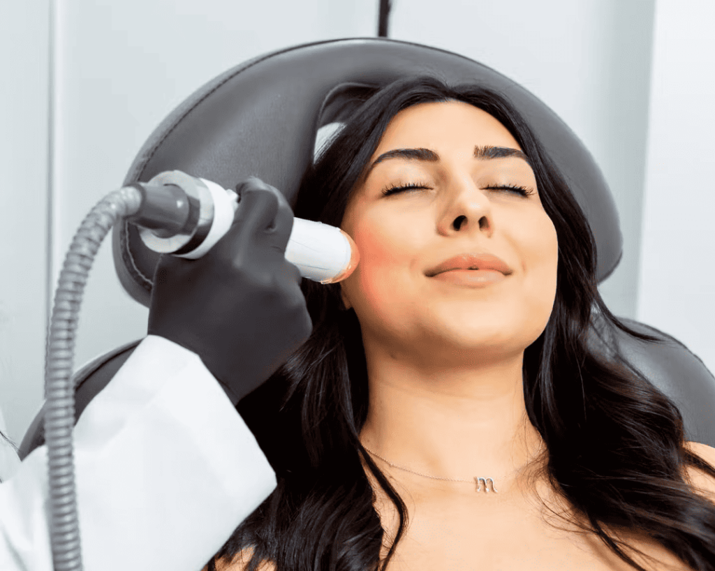 Radio Frequency Microneedling in Lee’s Summit, MO