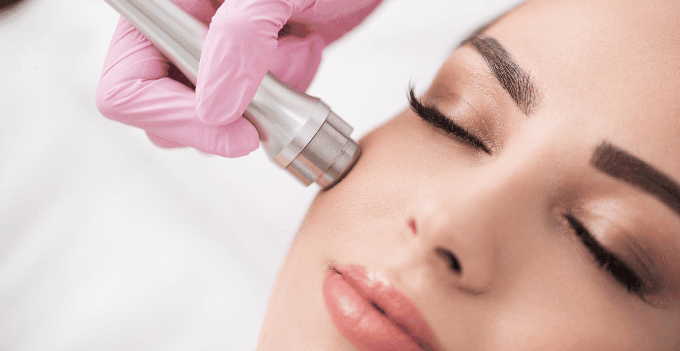 Does Microneedling Really Tighten Skin?